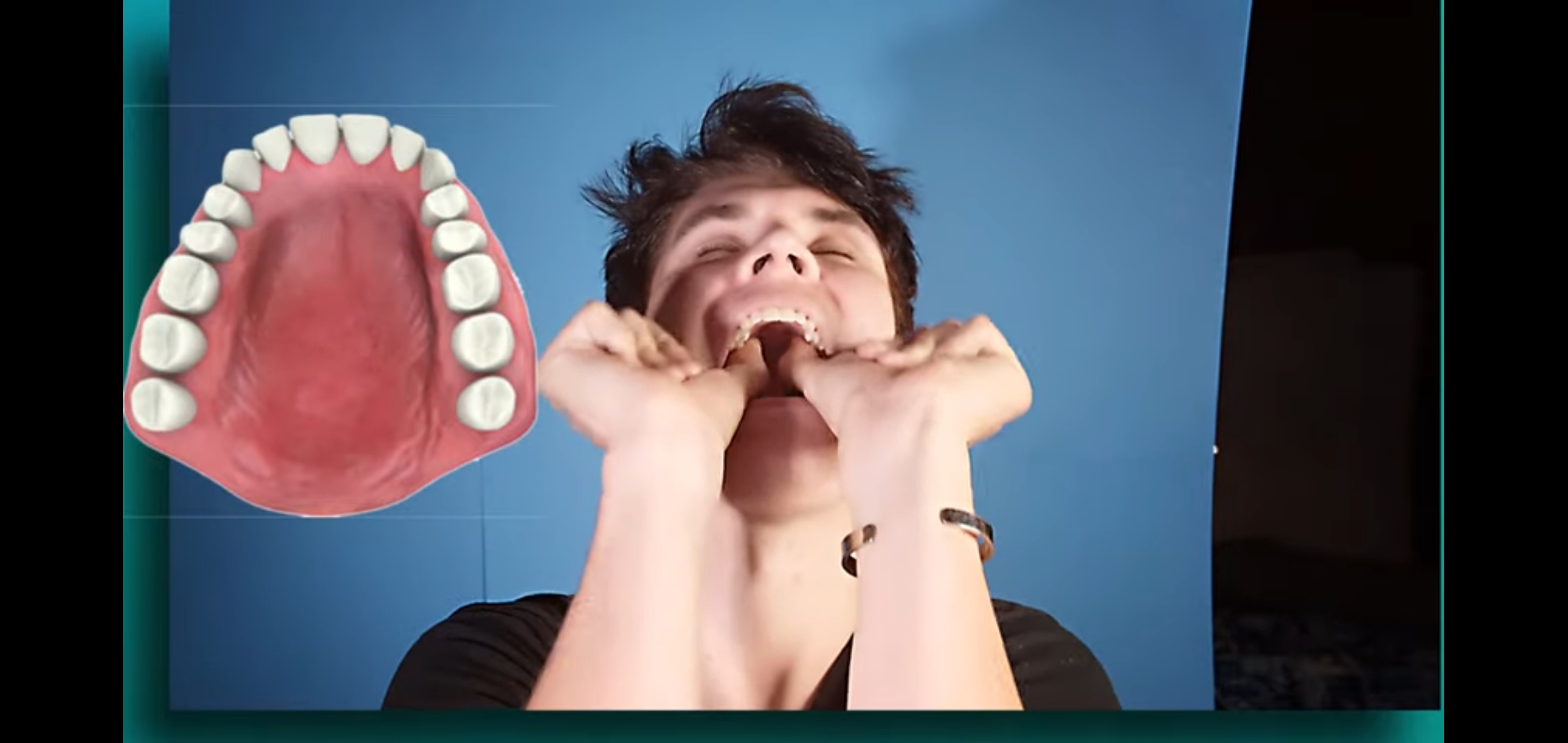 My official position on thumbpulling - by EGK - Reviv