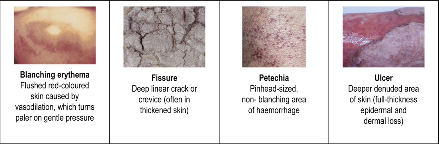 Wundbeschreibung in der Dermatologie – Ein Überblick