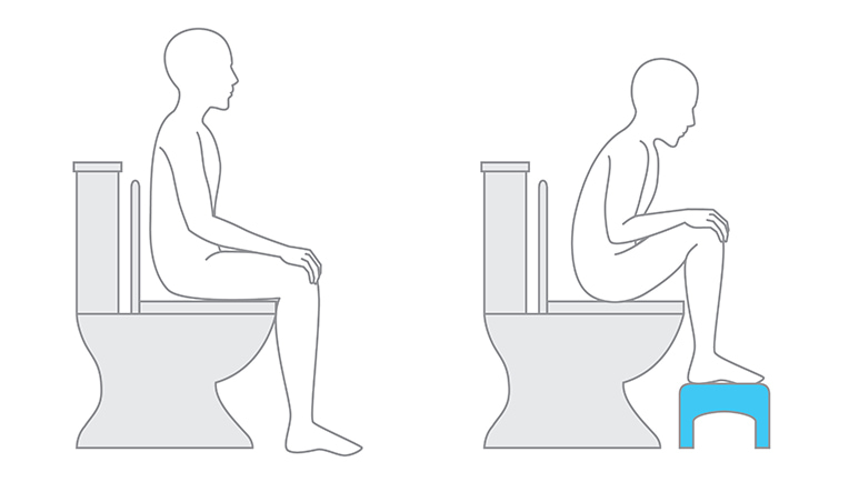 Constipated? Try These Sitting Positions