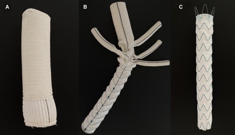 Síndromes Aórticas Agudas