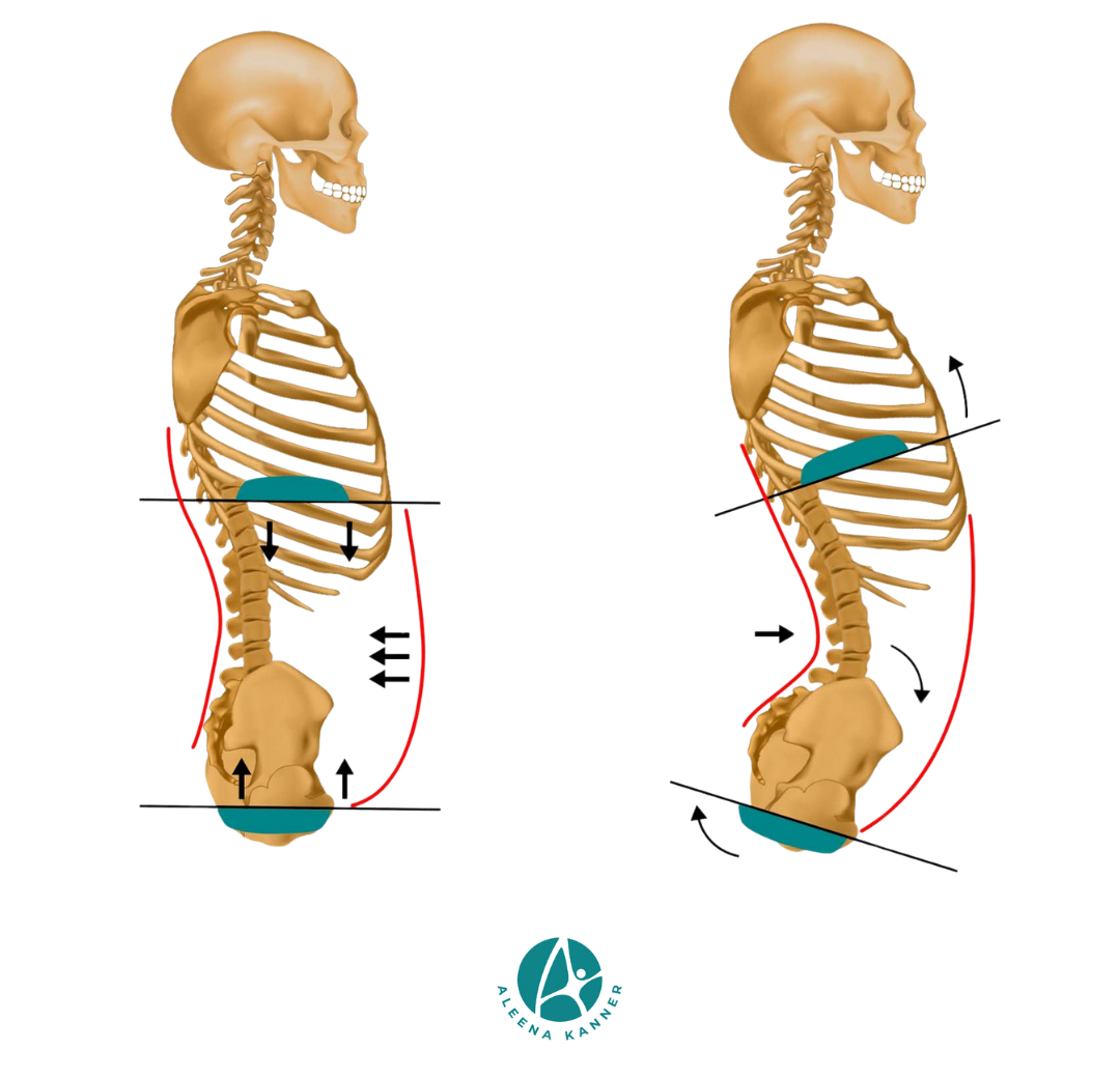Forward Head Posture: Why Your Neck Pain Isn’t Just About the Neck