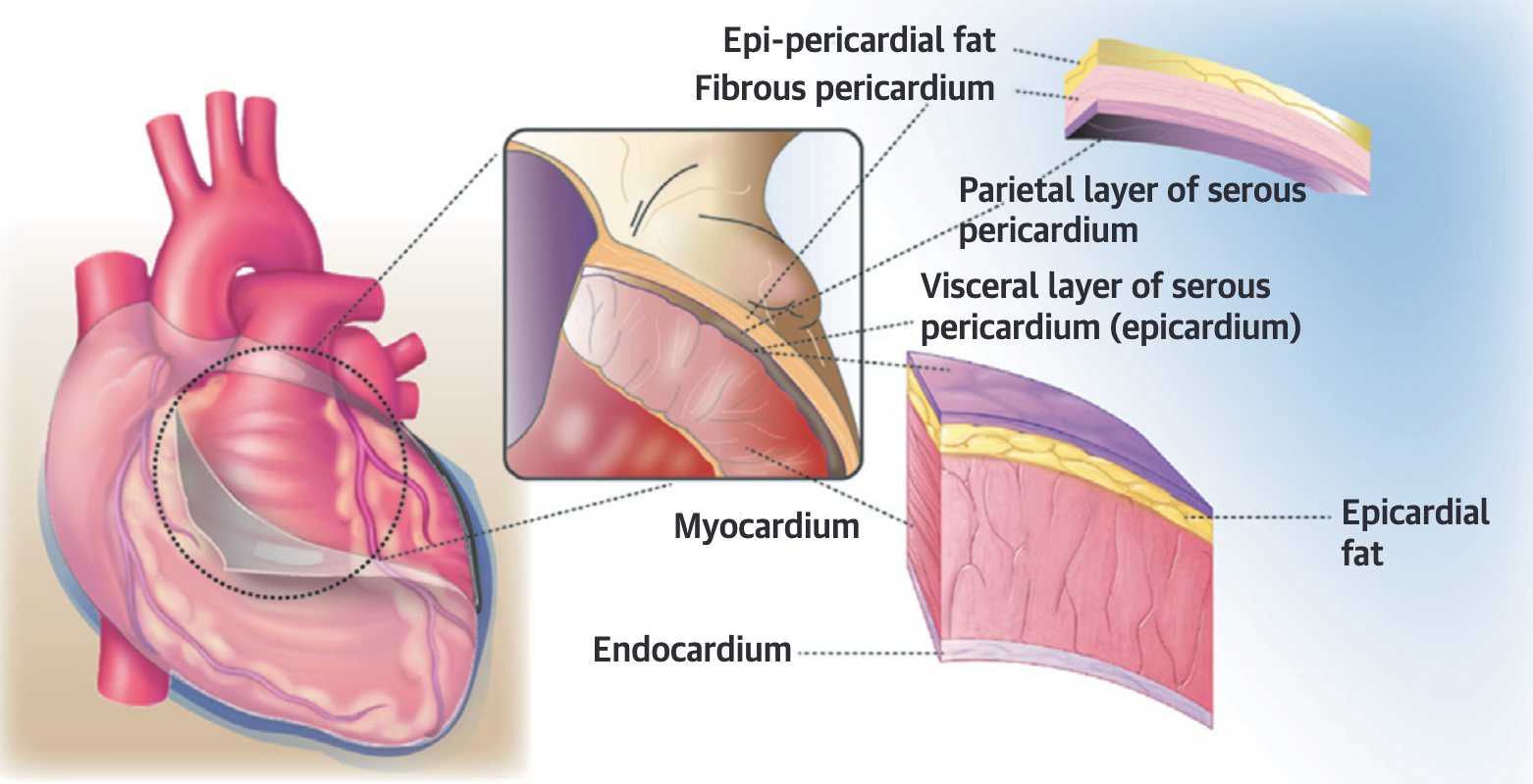Manejo do Derrame Pericárdico