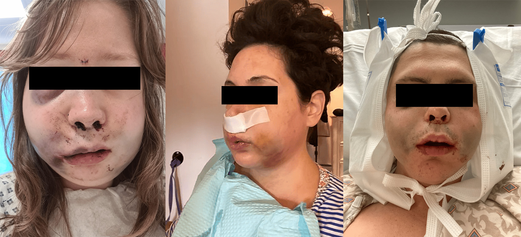 5.1 Intro to MARPE - by Ronald Ead - JawHacks