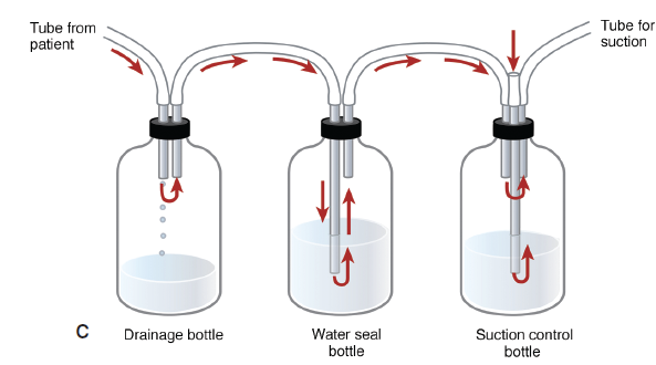 Chest Tubes & Pigtails: 5 Must-Know Tips for ICU Rotation