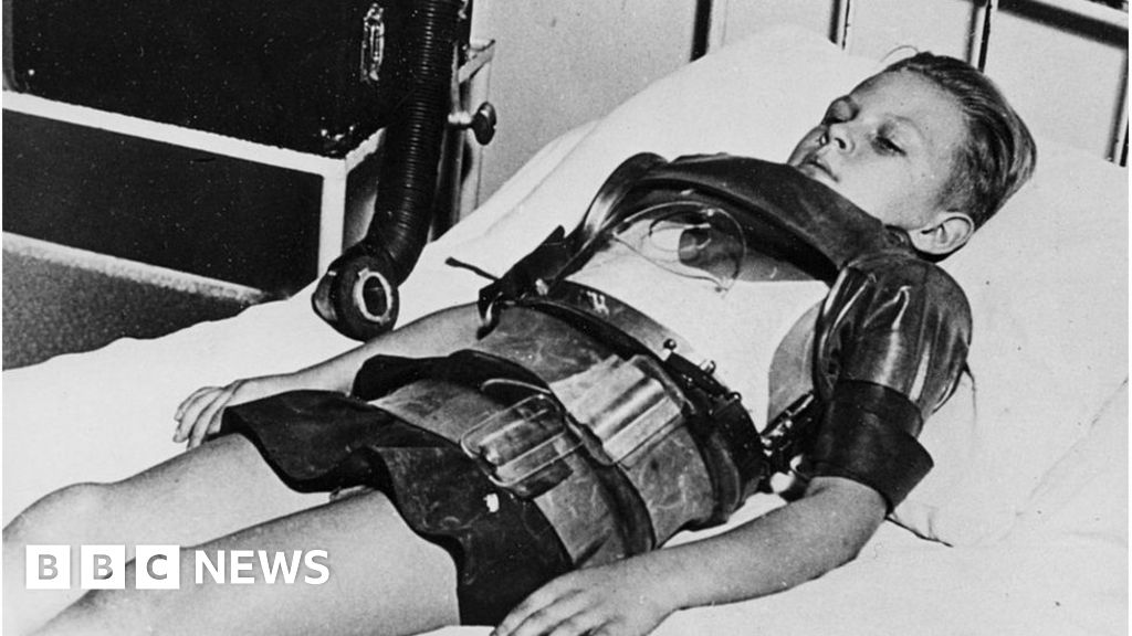 The Cutter Incident of 1955: A Polio Vaccine Tragedy