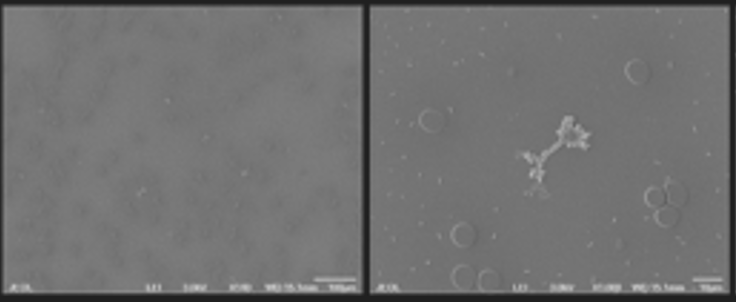 Electron Microscopy Of The Blood Of A 43 Year Old With 3 Pfizer ...