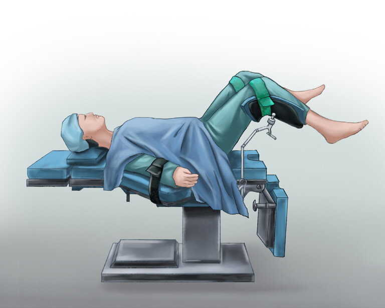 The Truth about Lithotomy Position - MEDILOQUY BLOG