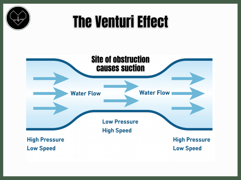 Mastering LVOT Obstruction Assessment: A Step-by-Step Approach