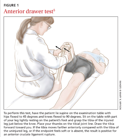 The ACL, Explained: How One Small Ligament Keeps Your Knee From Coming ...