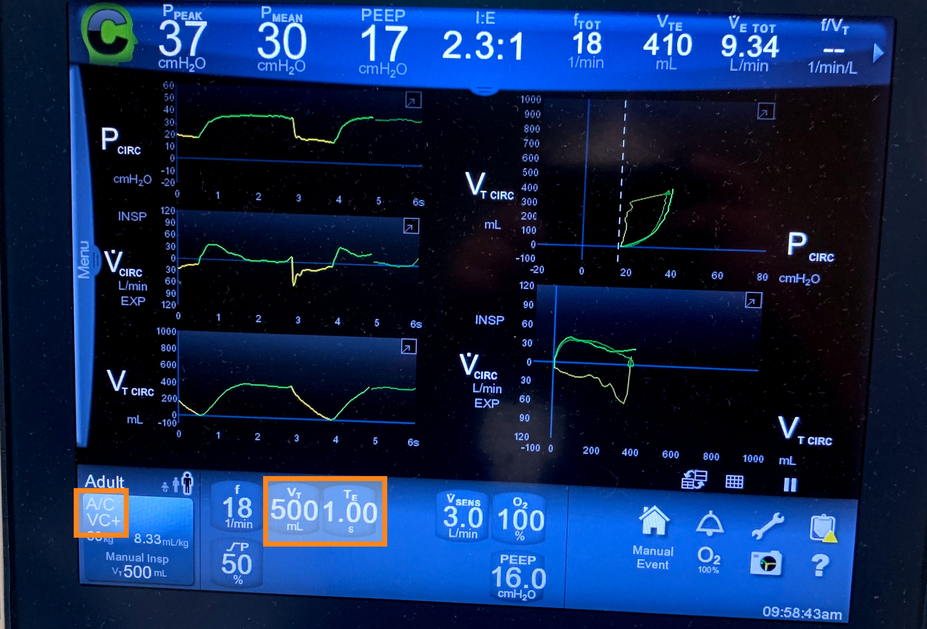 Mechanical Ventilation Made Simple: 9 Concepts Every Non-ICU Doc Should ...