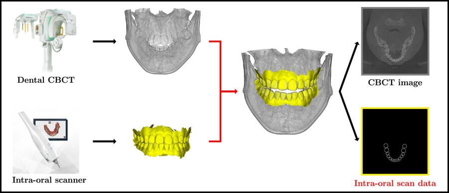 5.3 Top MARPE Devices Currently Available - JawHacks