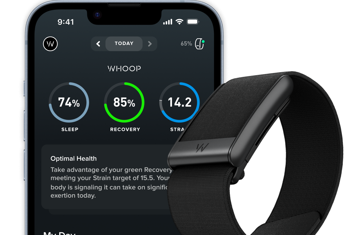 Whoop: La "Pulsera" Que Usa Agustín Tapia y Arturo Coello