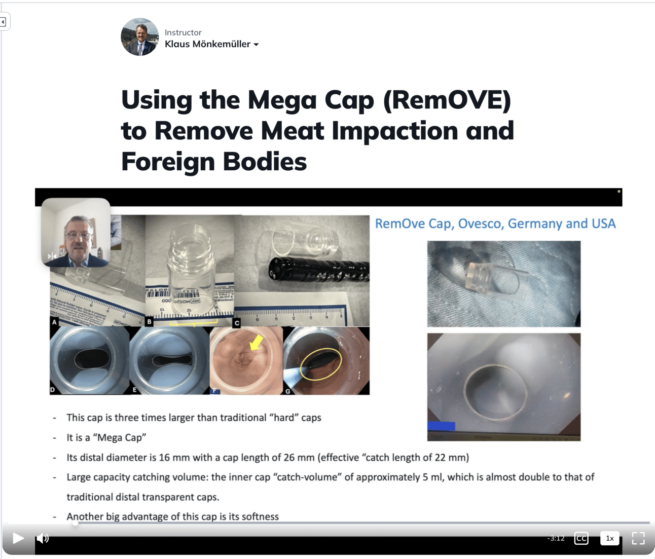 How to Deploy a Capsule Endoscope During EGD