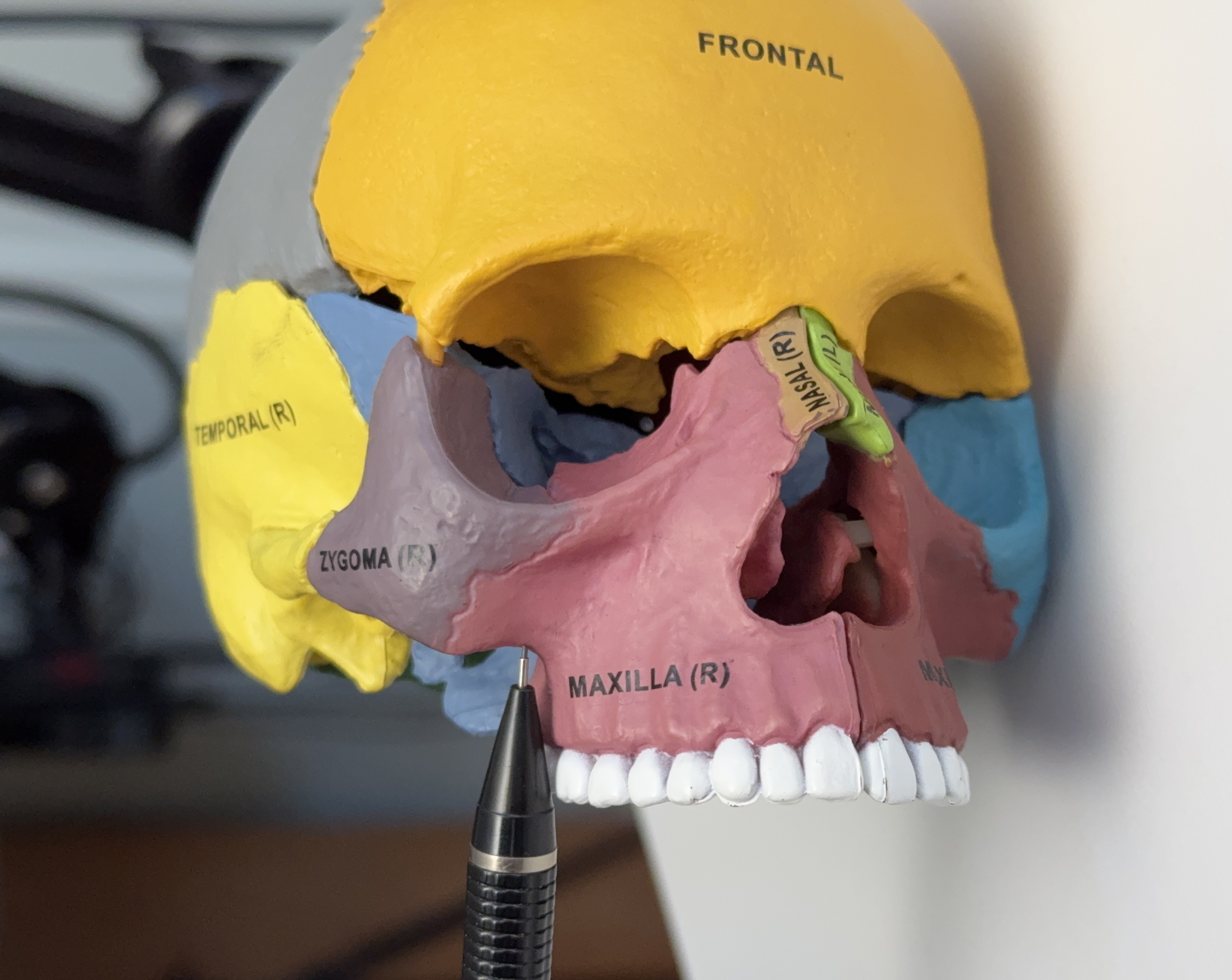 5.4 MARPE Surgical Assists - From Least to Most Invasive