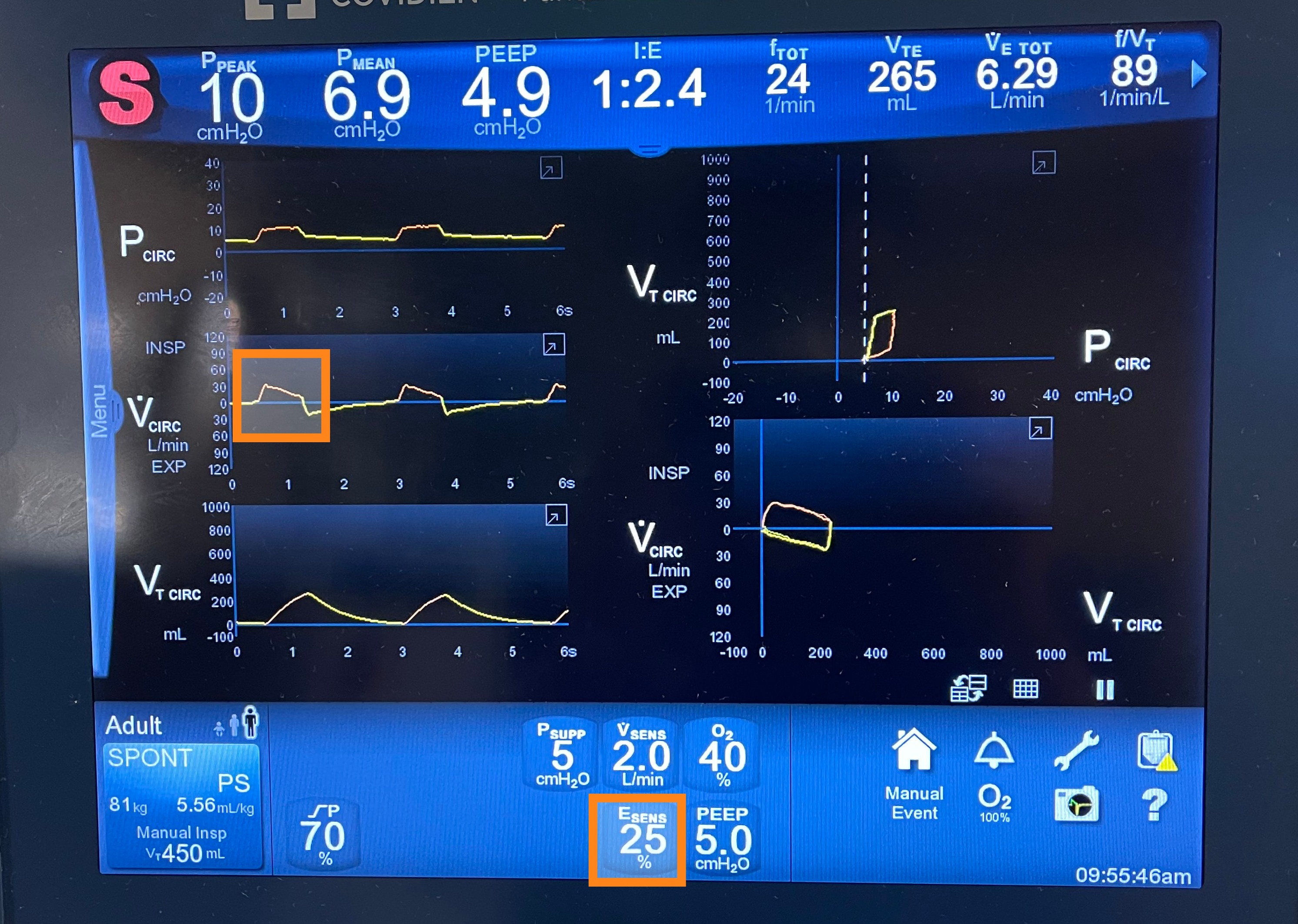 Mechanical Ventilation Made Simple: 9 Concepts Every Non-ICU Doc Should ...