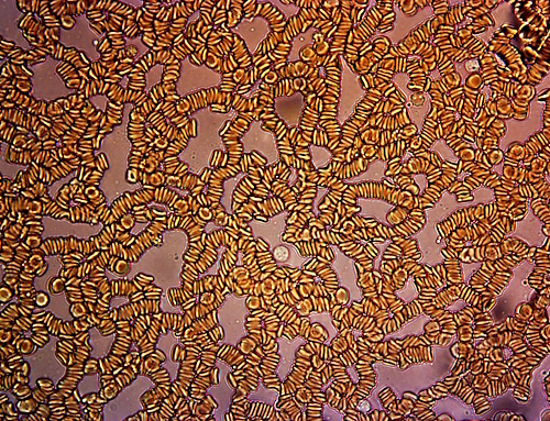 The Source of Blood Coagulation: Cross Domain Bacteria (CDB)