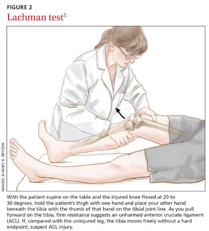 The ACL, Explained: How One Small Ligament Keeps Your Knee From Coming ...