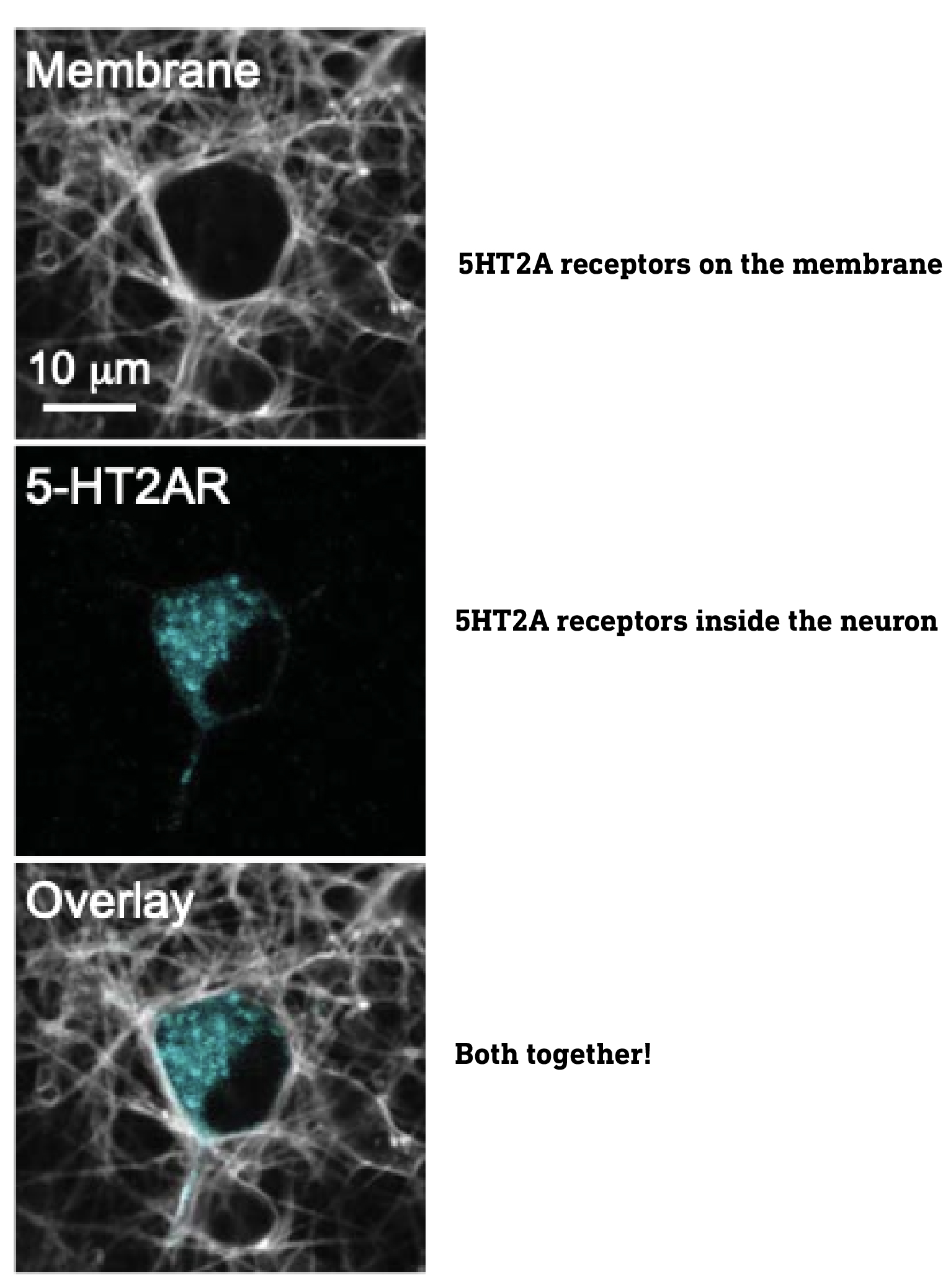 Psychedelics, neuroplasticity, and intracellular 5HT2A receptors...