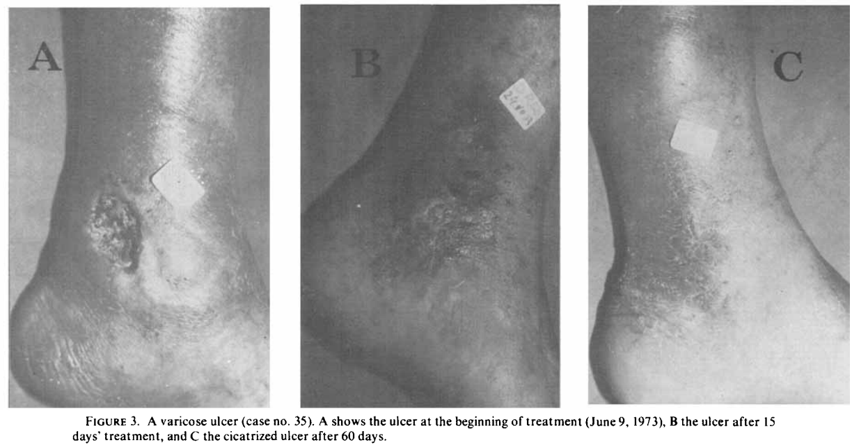 DMSO Revolutionizes Skin Care and Dermatology