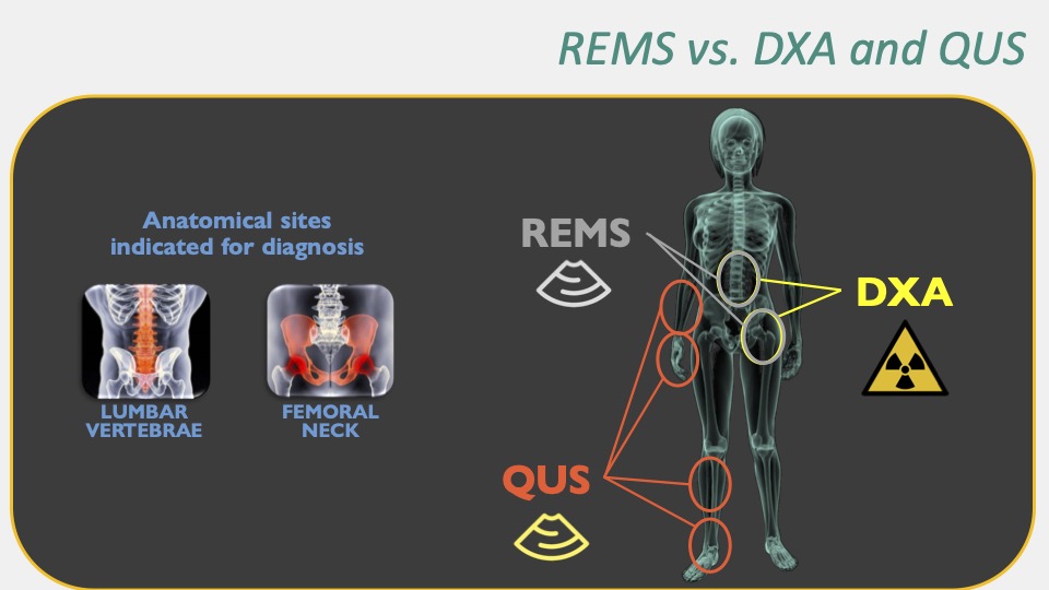 R.E.M.S. - by A Midwest Doctor