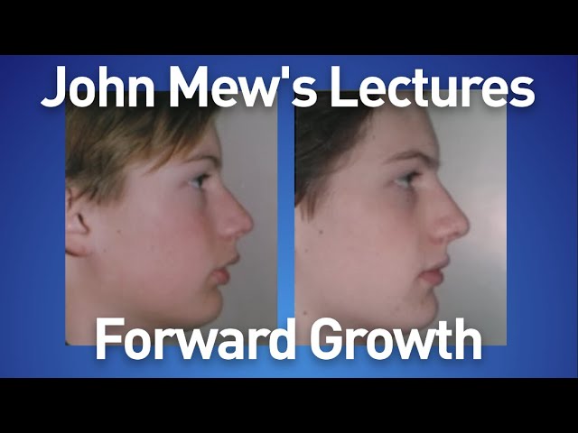 Why I don't call this 'forward growth' - by EGK - Reviv