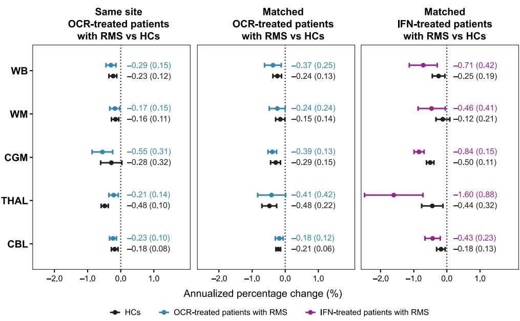 SAW - smoldering-MS-associated worsening