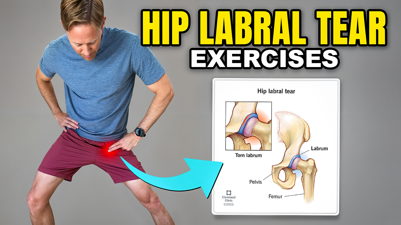 Hip Labral Tear Rehabilitation - by Dr. Tom Walters
