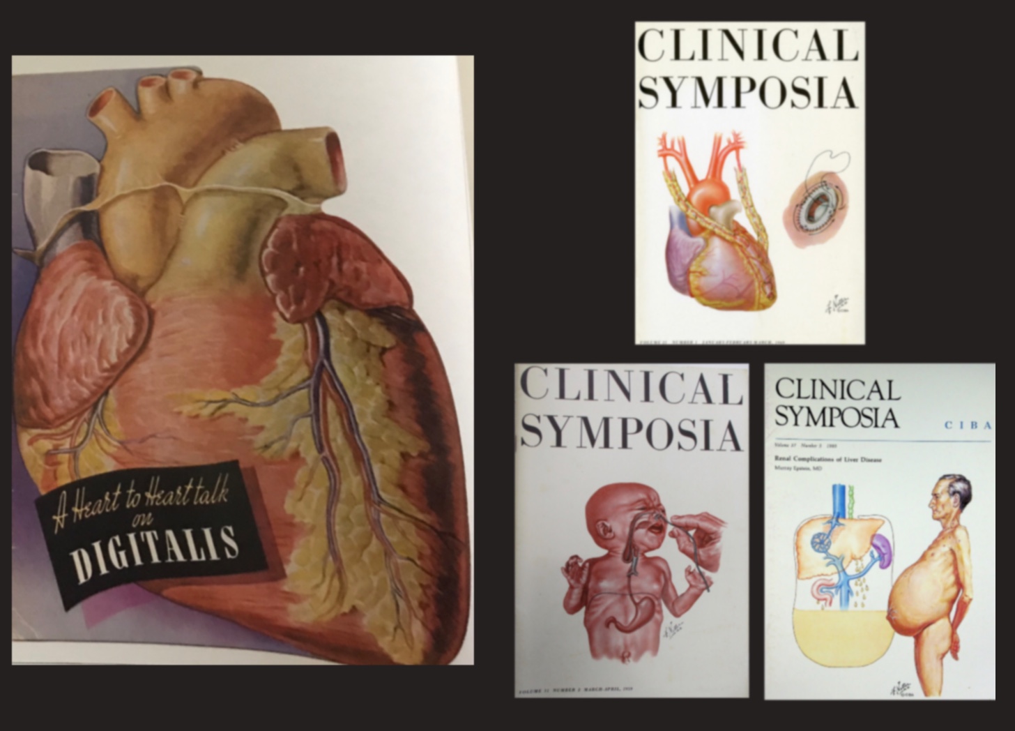 Who was Frank H. Netter, MD? - by Sapana Adhikari, MD