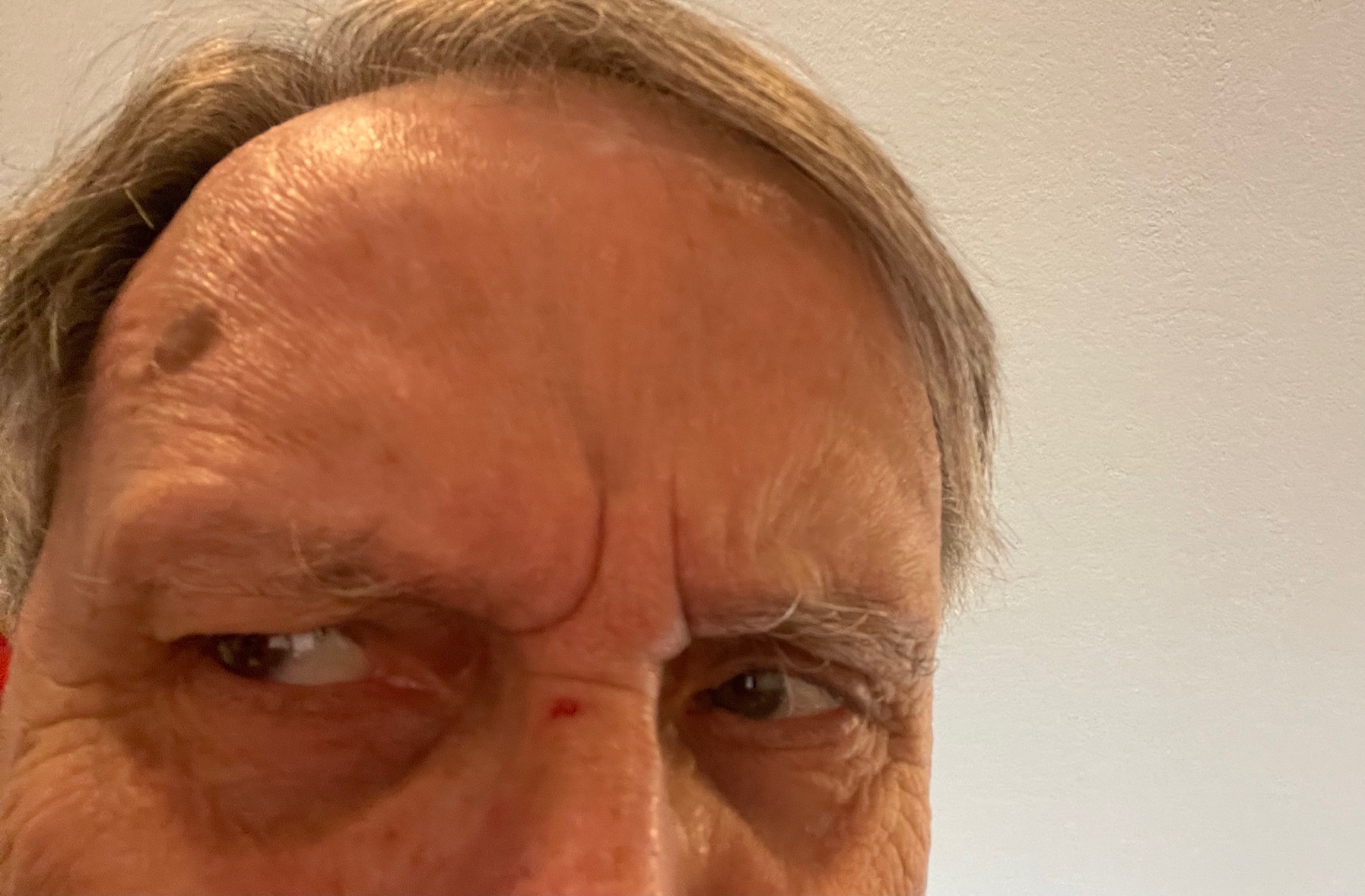 The thing about getting my eyes fixed: Cataracts are gone, everything’s ...