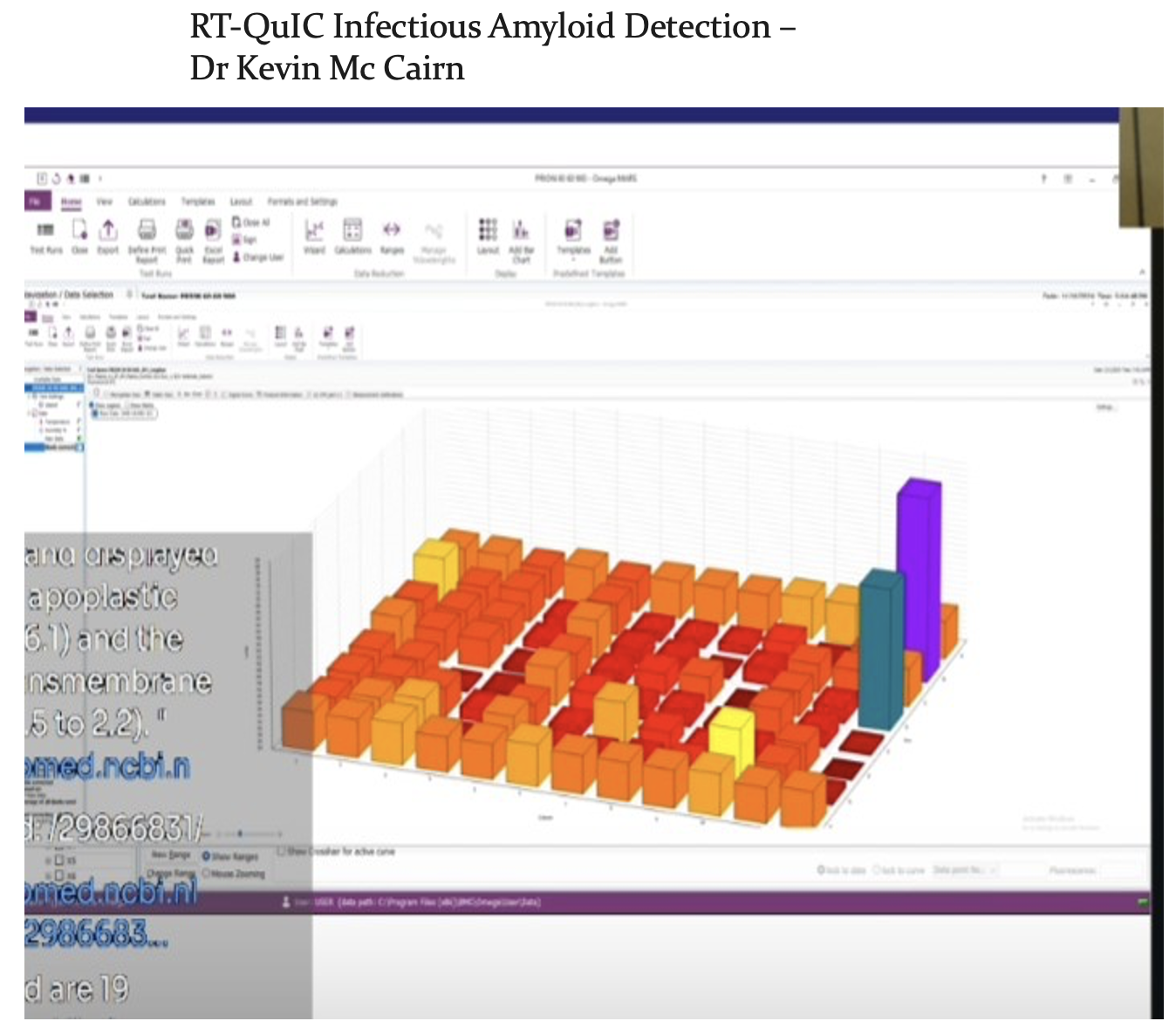 Microscopic and Biochemical Analysis of Anomalous White Fibrous Clots ...