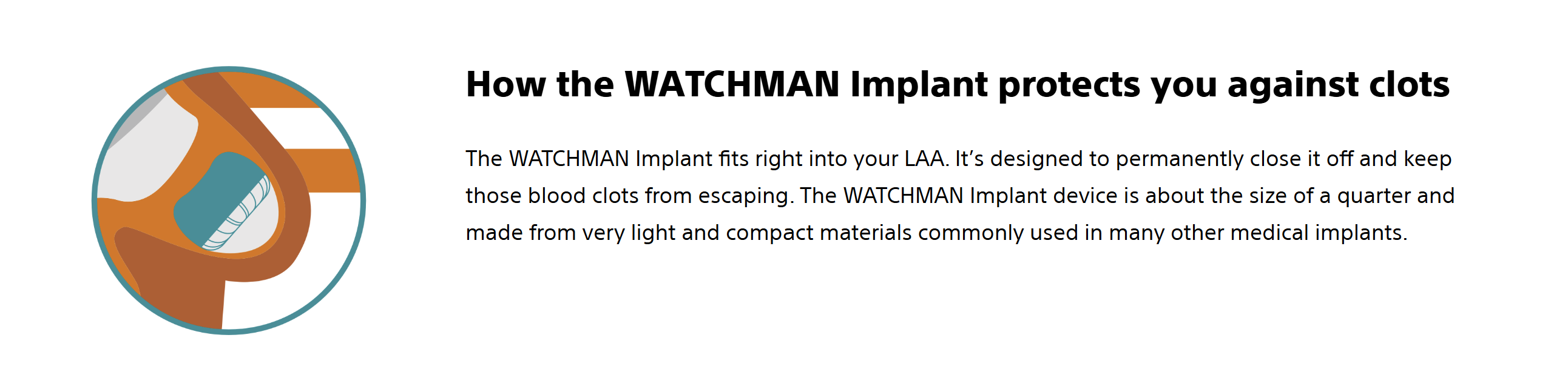 The WATCHMAN™ Device-Left Atrial Appendage Closure (LAAC) Implant