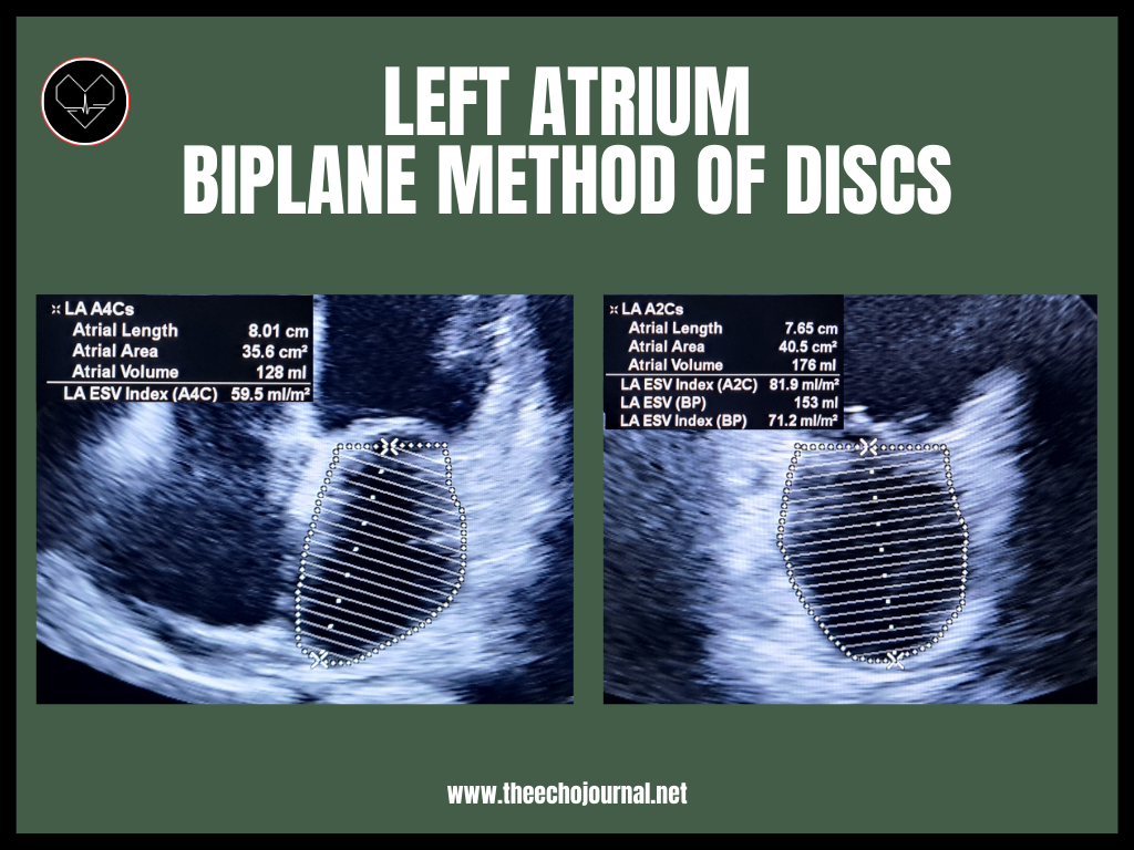 Apical 2 and 3: Acquisition, Angles, and Accuracy