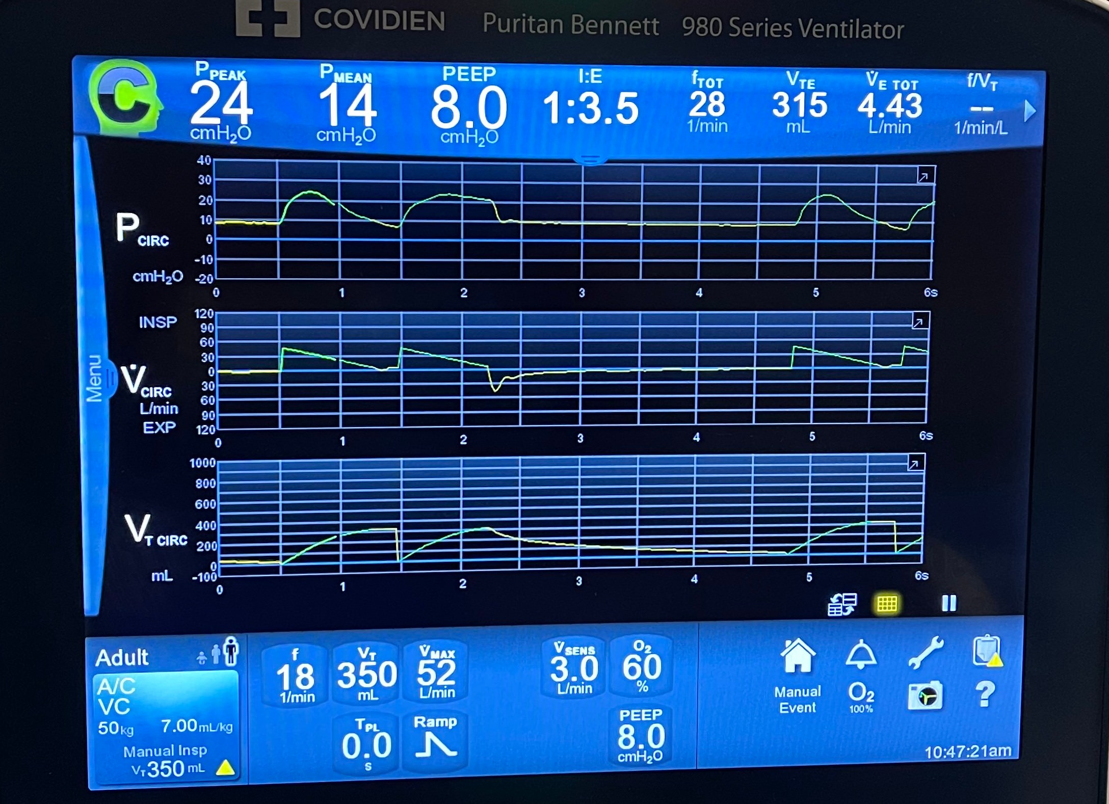 Mechanical Ventilation Made Simple: 9 Concepts Every Non-ICU Doc Should Know