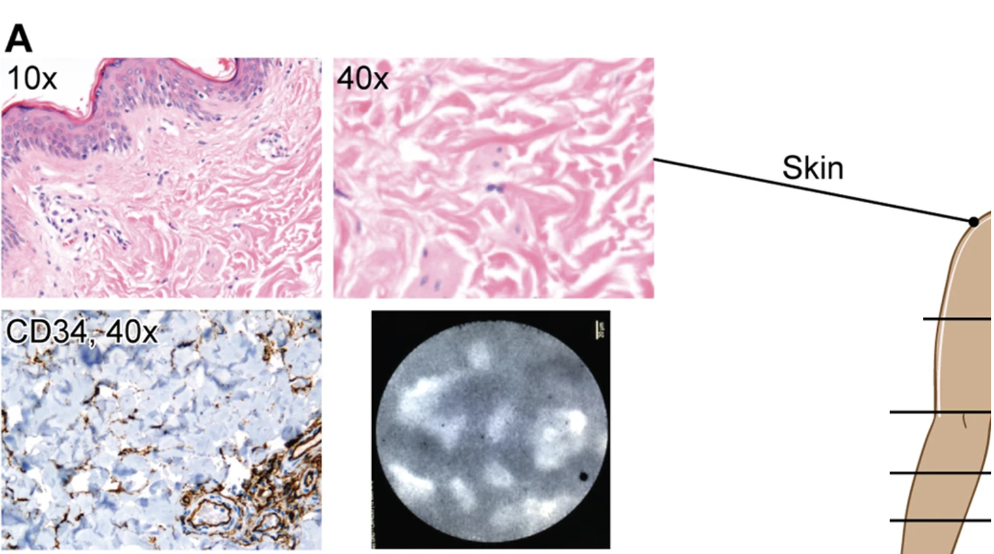 What Moves Water Inside the Body? - by A Midwestern Doctor