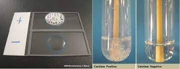 Catalase Test- Principle, Procedure, and Result Interpretation.