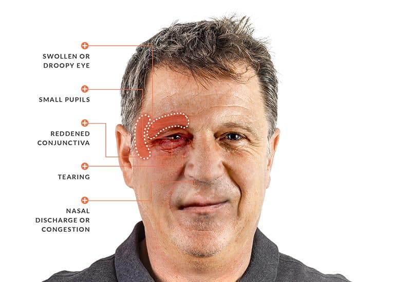Pain in the Brain: The Surprising Origins of Headaches 🧠