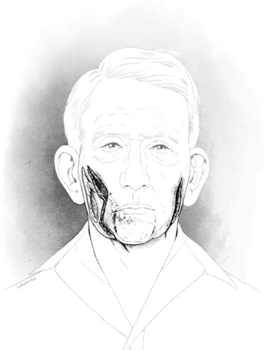 The Assassination Attempt of William Seward (1865)