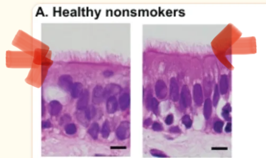 MUST SEE VIDEO: La Quinta Columna Microscopy Study Shows Tobacco's ...