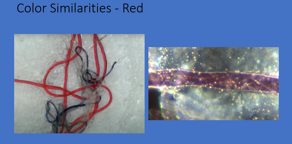Comparison Images of Live Blood Analysis and Nanotechnology Coming Out ...