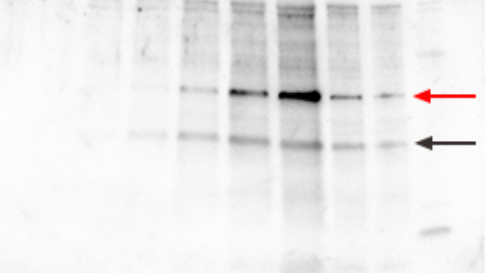 The 8 Western Blot Failures and How to Prevent Them (2025 Guide)
